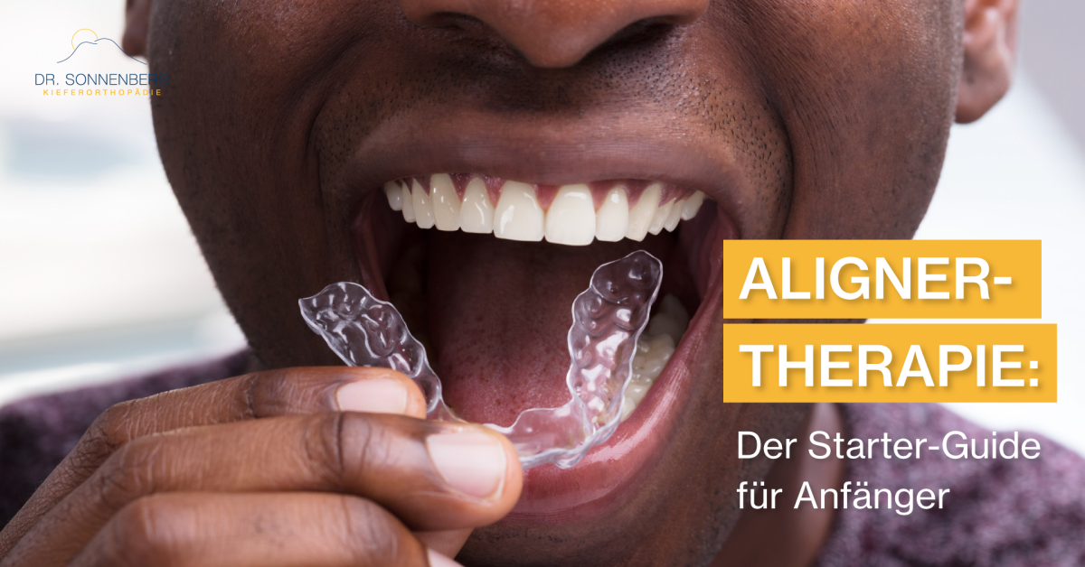Aligner-Therapie: Der Starter-Guide für Anfänger - Aktuelle News ...