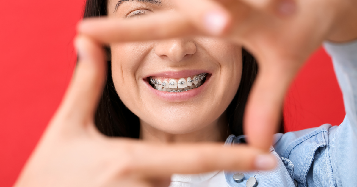 Wie beeinflusst eine Zahnspange die Aussprache?