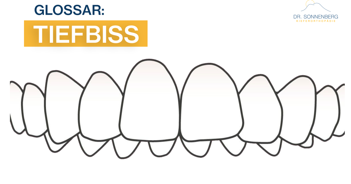 Tiefbiss: Ursachen und Behandlung - Aktuelle News | Praxis für ...