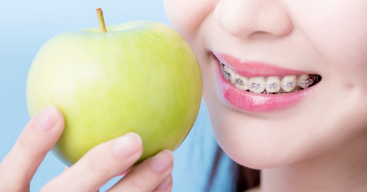 Band oder Bracket gelöst – was tun? - medondo.health